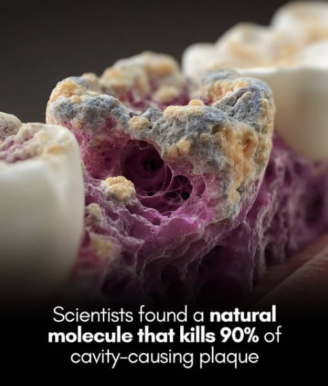 Broccoli Molecule Kills 90% of Cavity Bacteria GagBase | AI-powered ...
